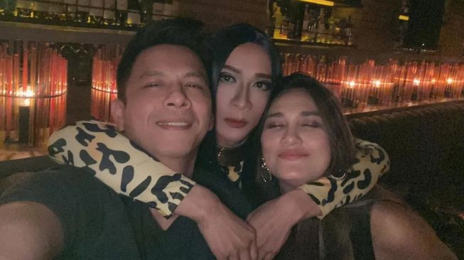 Tak Mau Jadi Musuh, Luna Maya Pilih Jaga Hubungan Baik dengan Ariel Noah